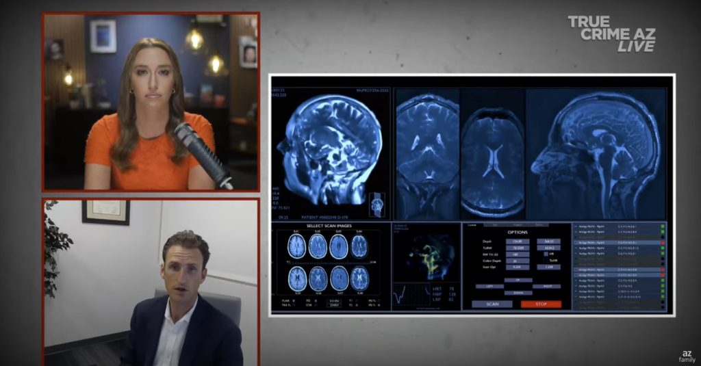 Dr. Rory Murphy Featured on True Crime AZ: How CTE Impacts the Brain in ...